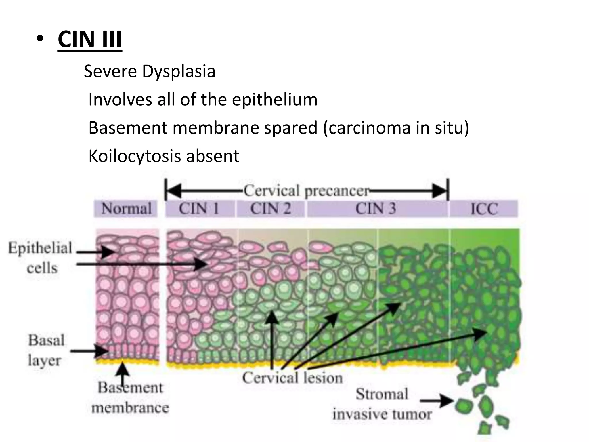 Cervical neoplasms | PPTX