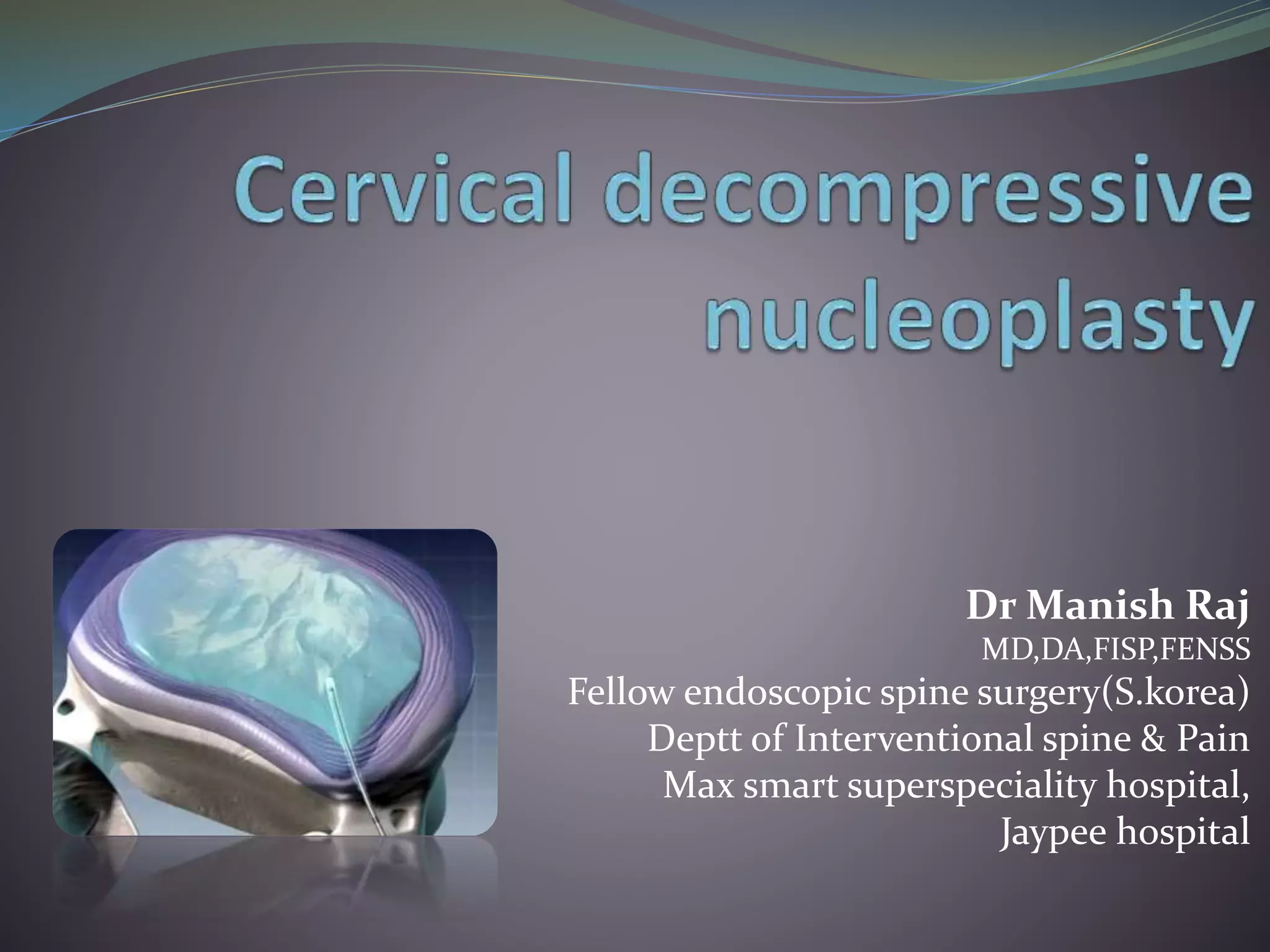 Cervical nucleoplasty | PPTX