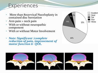 Cervical nucleoplasty | PPT