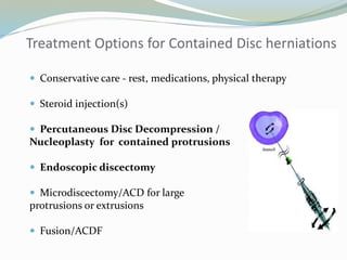 Cervical nucleoplasty | PPT