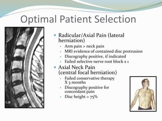 Cervical nucleoplasty | PPT