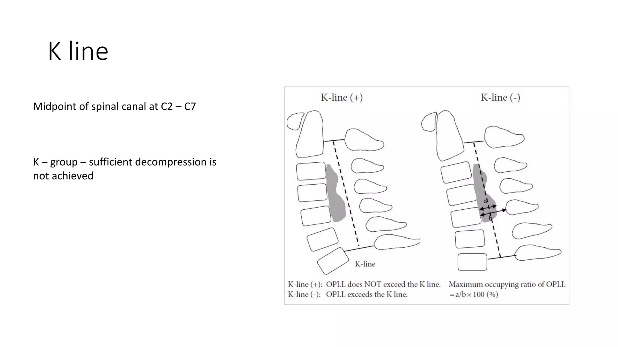 Cervical opll | PPTX