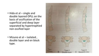 Cervical opll | PPTX