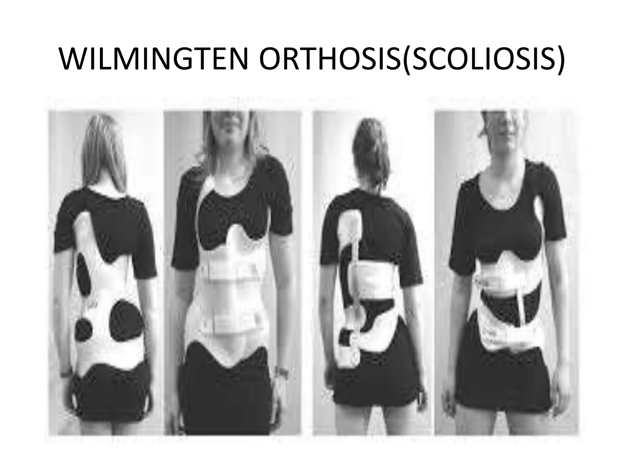 Cervical orthosis | PPTX