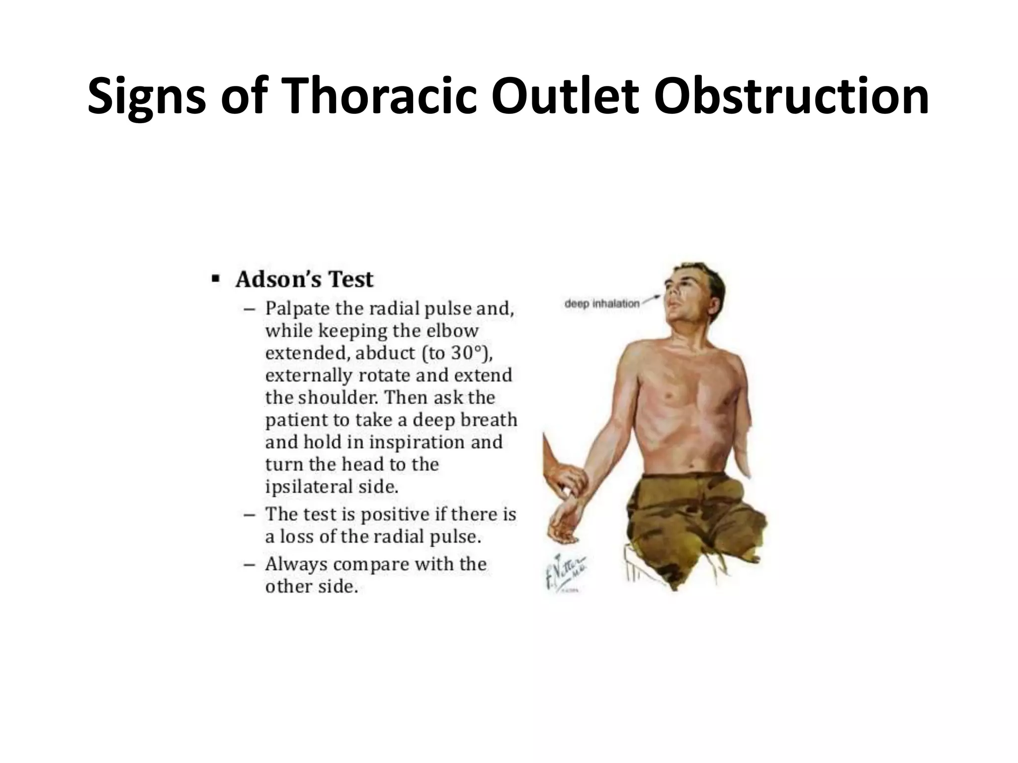 Cervical Spine Pain - Dr S L Yadav | PPTX