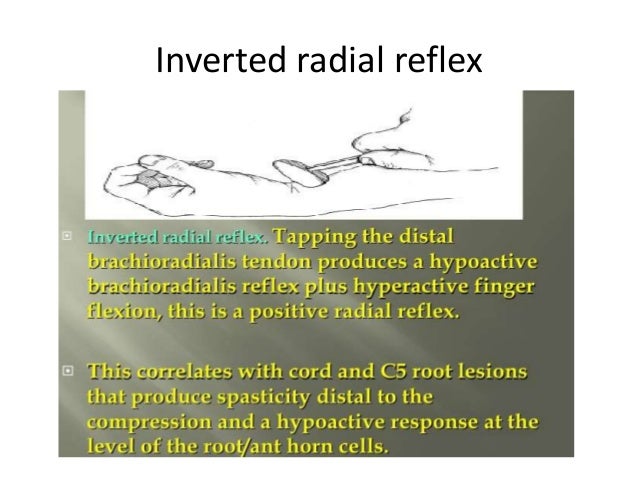 Cervical Spine Pain - Dr S L Yadav