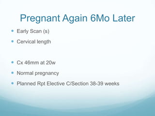 Cervical pregnancy | PPT