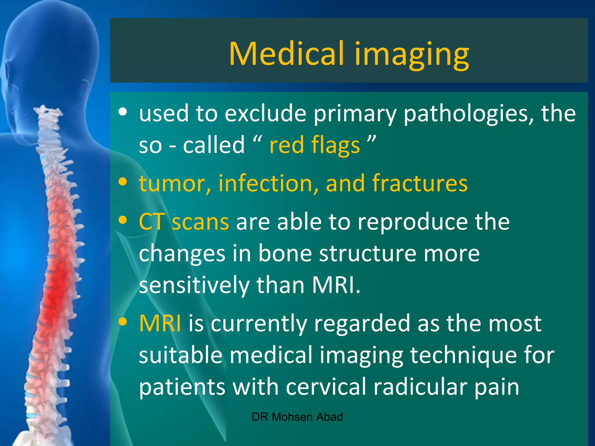 Cervical radicular pain | PPT