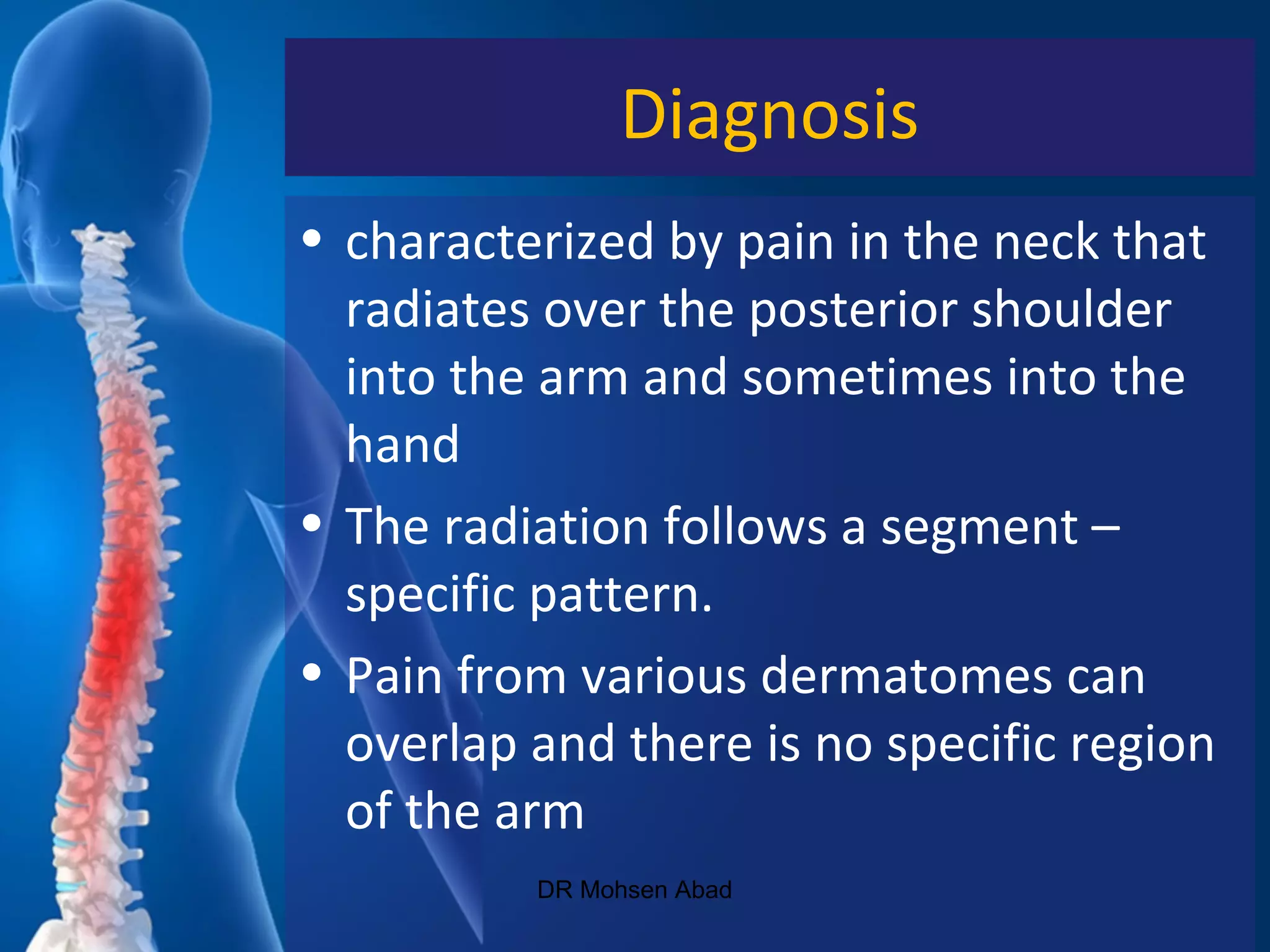 Cervical radicular pain | PPT