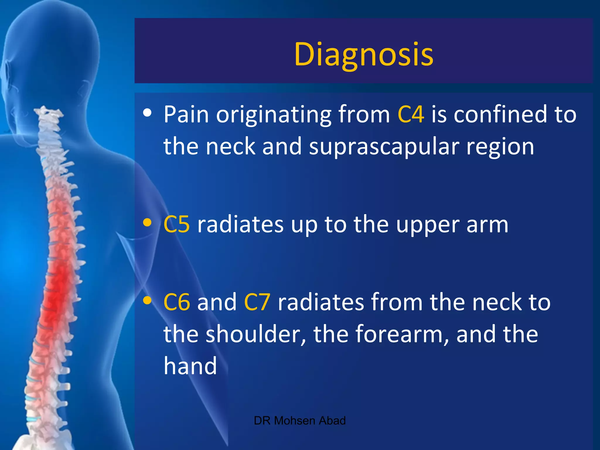 Cervical radicular pain | PPT