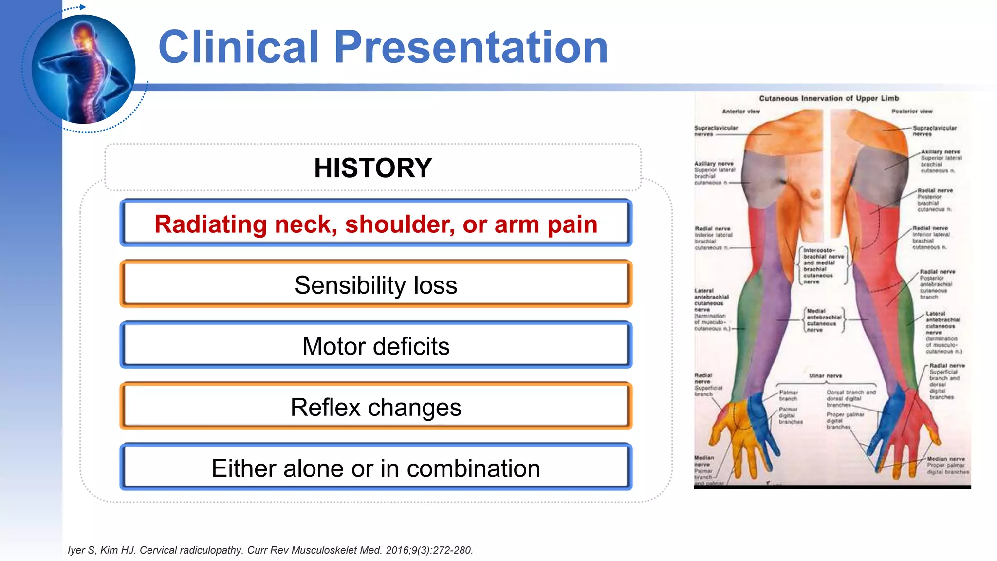 Cervical radiculopathy | PPTX