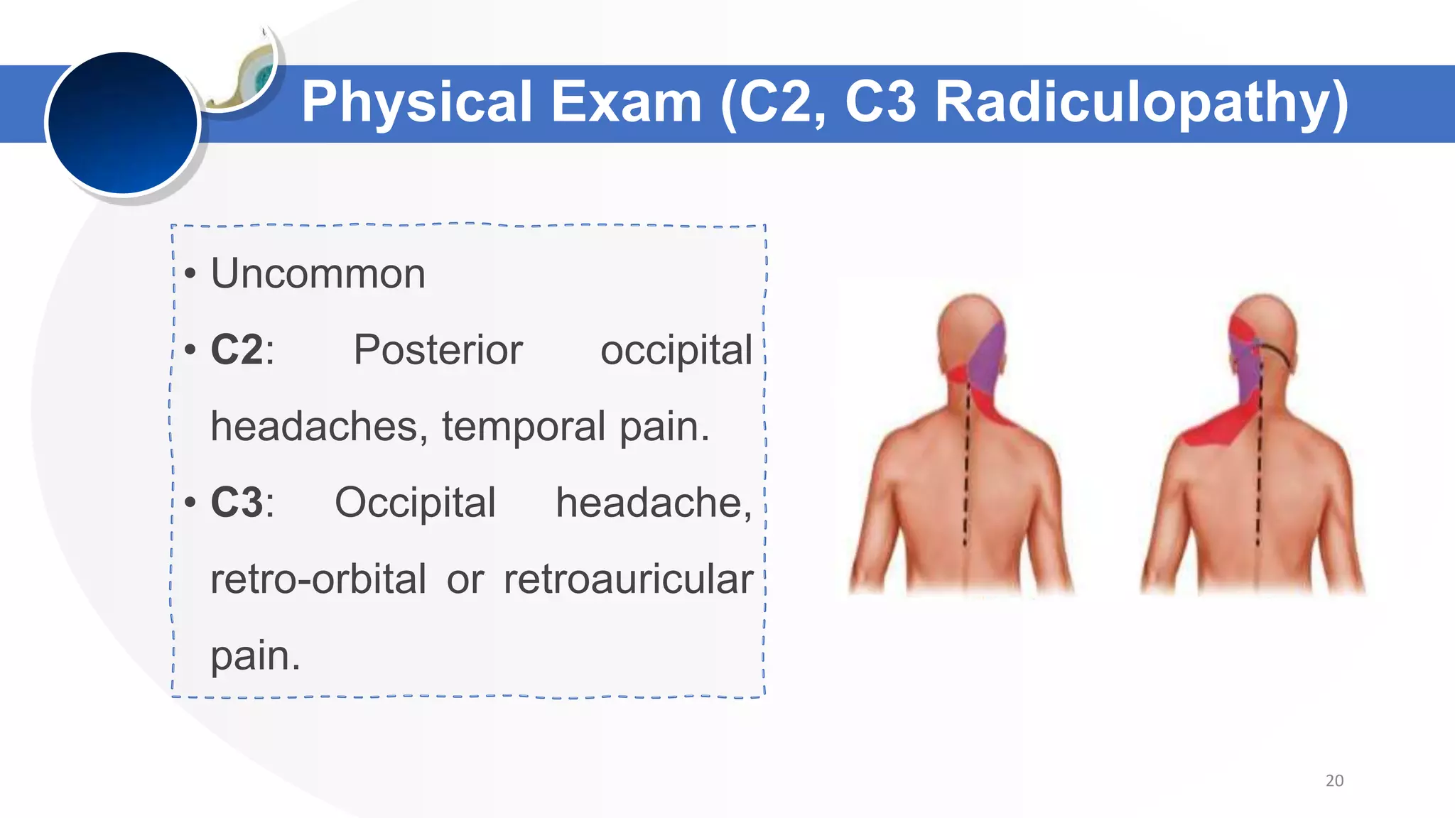 Cervical radiculopathy | PPTX