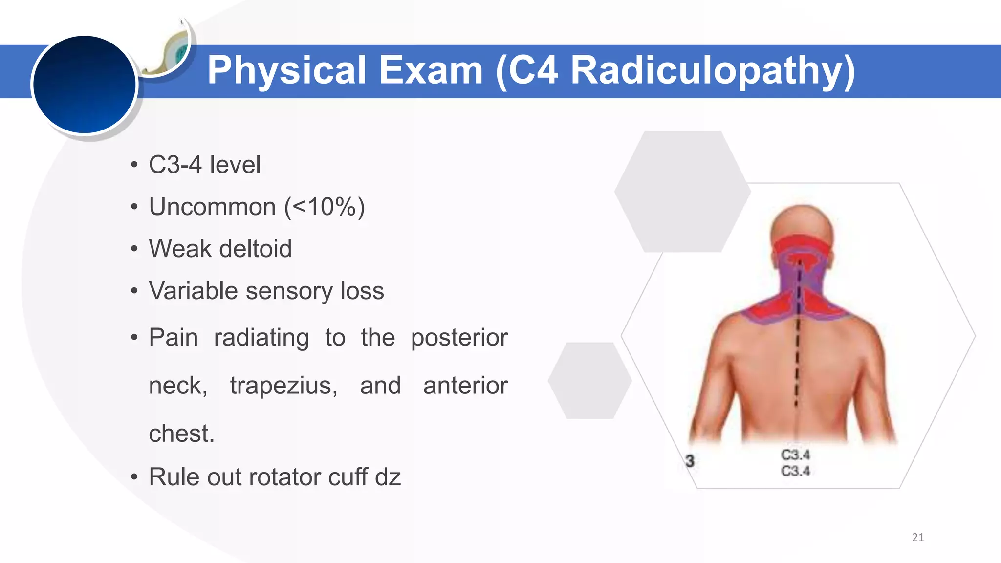 Cervical radiculopathy | PPTX