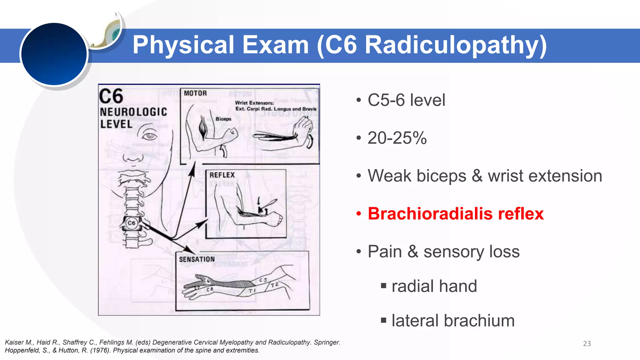 Cervical radiculopathy | PPTX