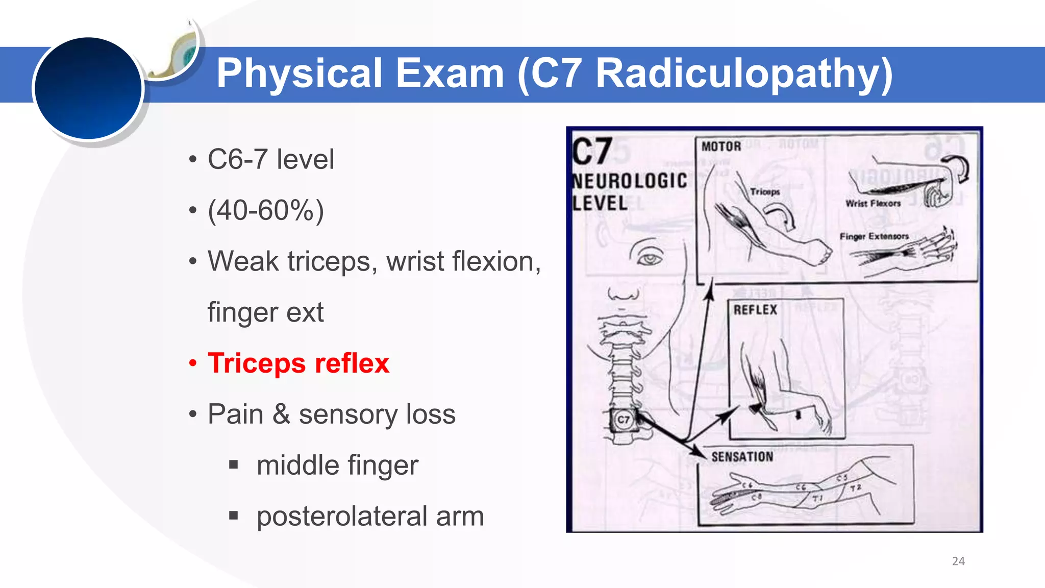 Cervical radiculopathy | PPTX