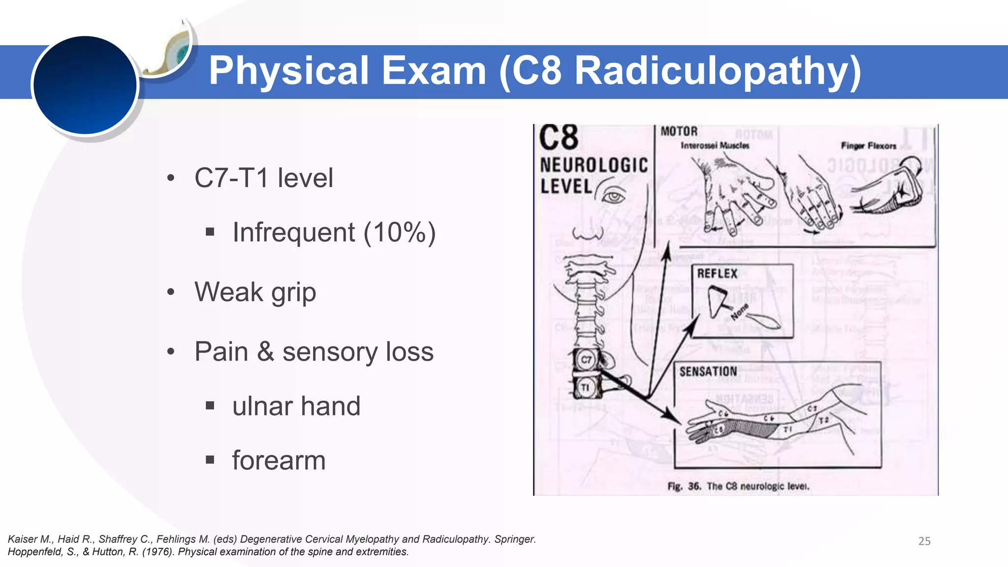 Cervical radiculopathy | PPTX