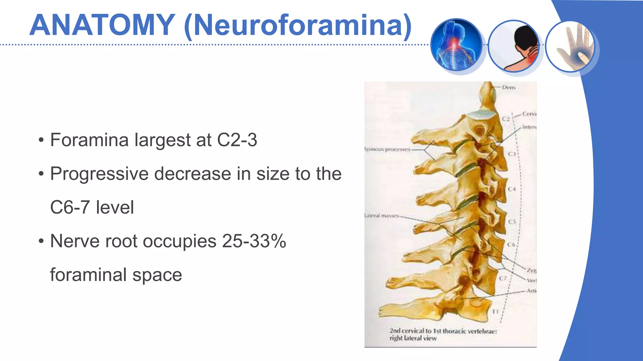 Cervical radiculopathy | PPTX