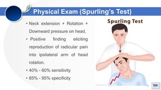 Cervical radiculopathy | PPTX
