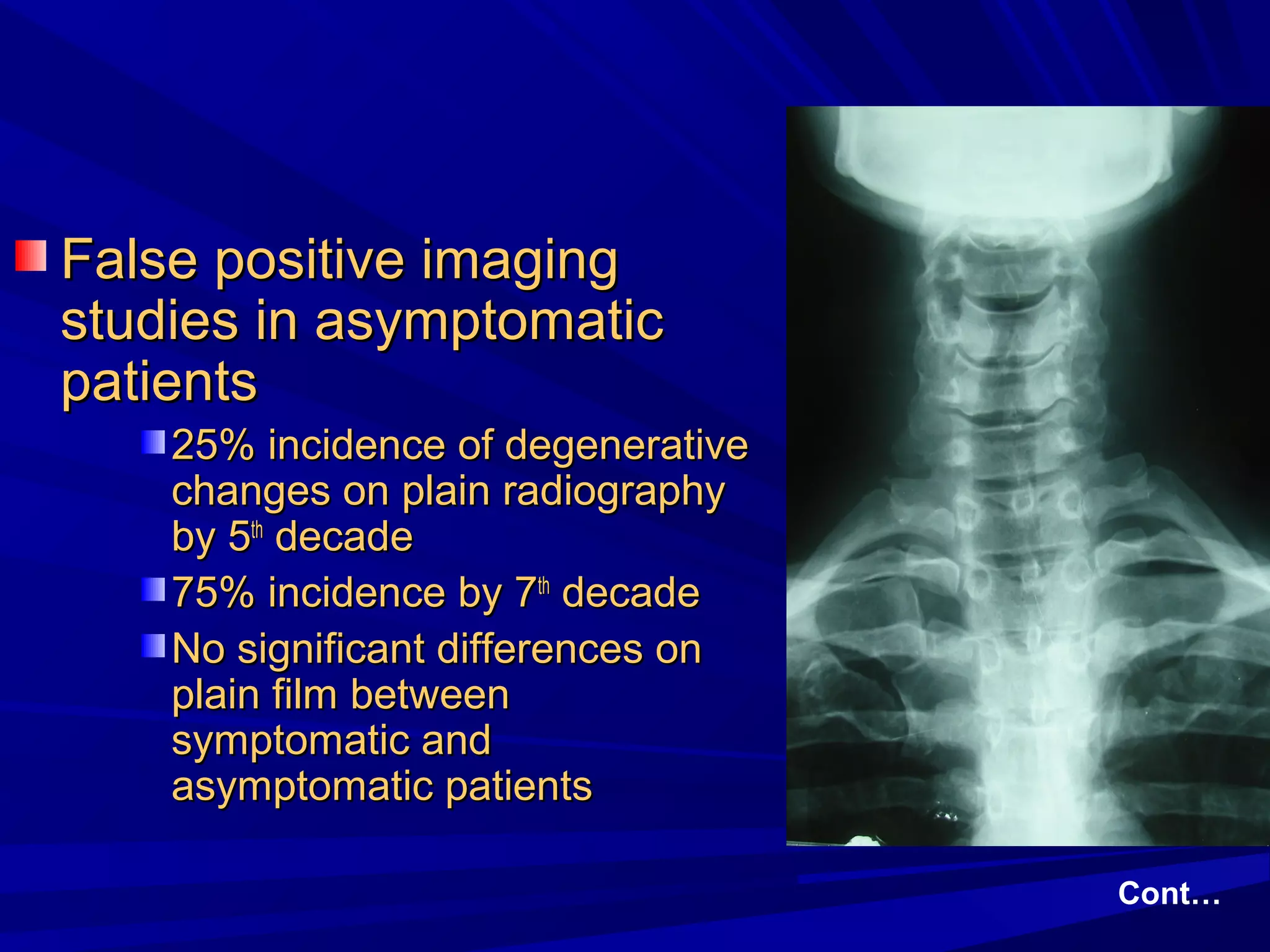 Cervical radiculopathy 1st mech diag 2008 | PPT