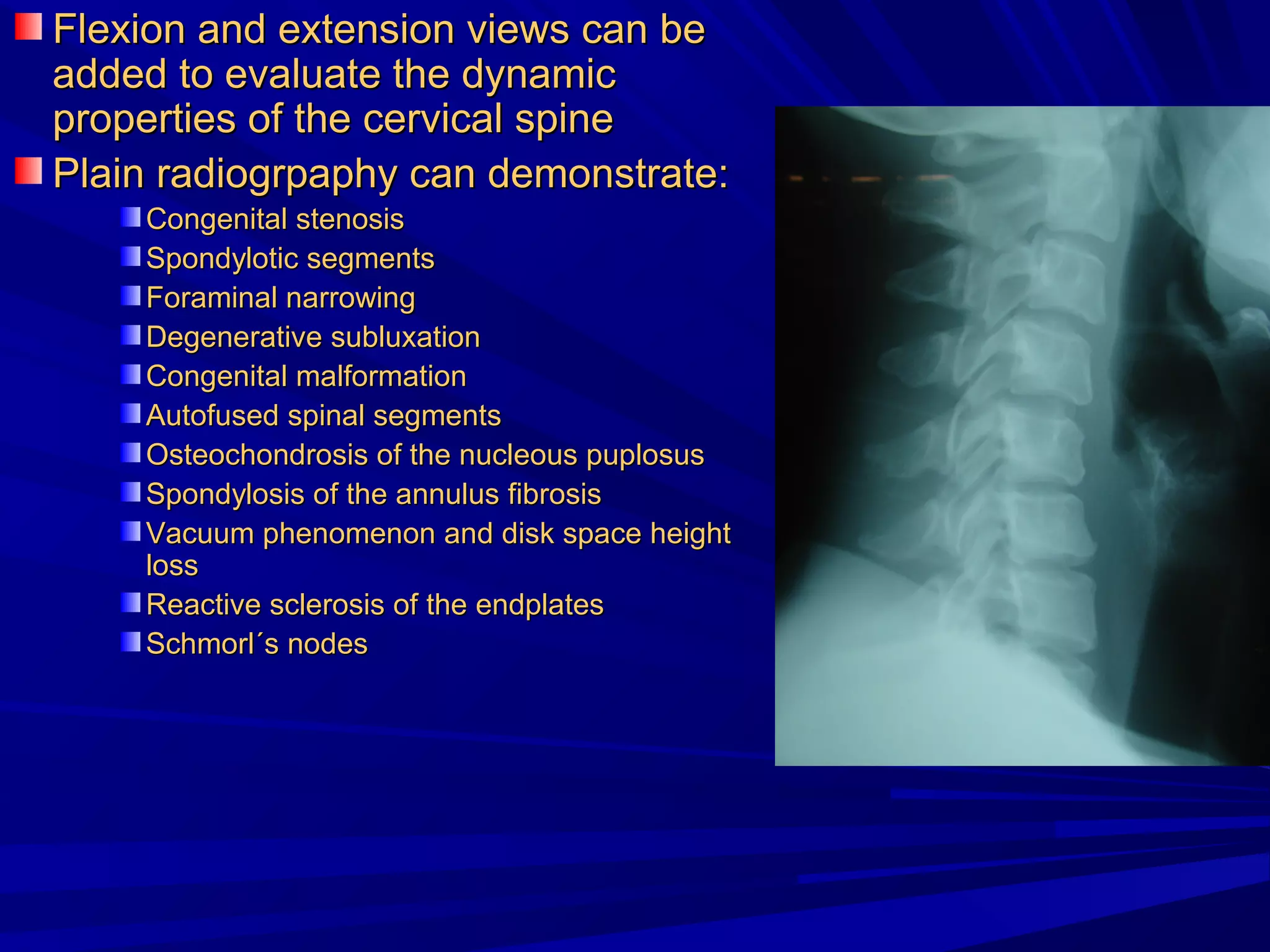 Cervical radiculopathy 1st mech diag 2008 | PPT