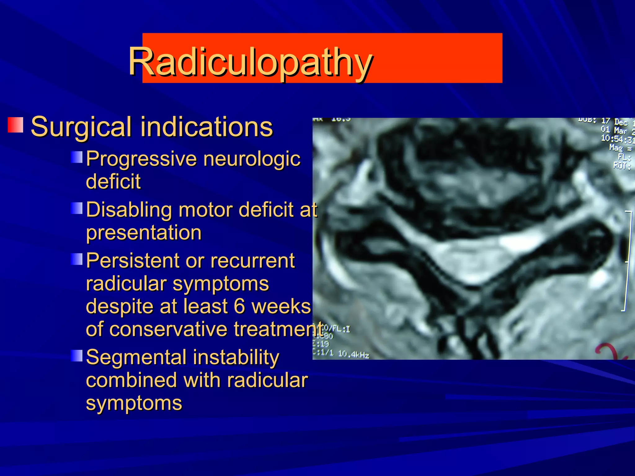 Cervical radiculopathy 1st mech diag 2008 | PPT