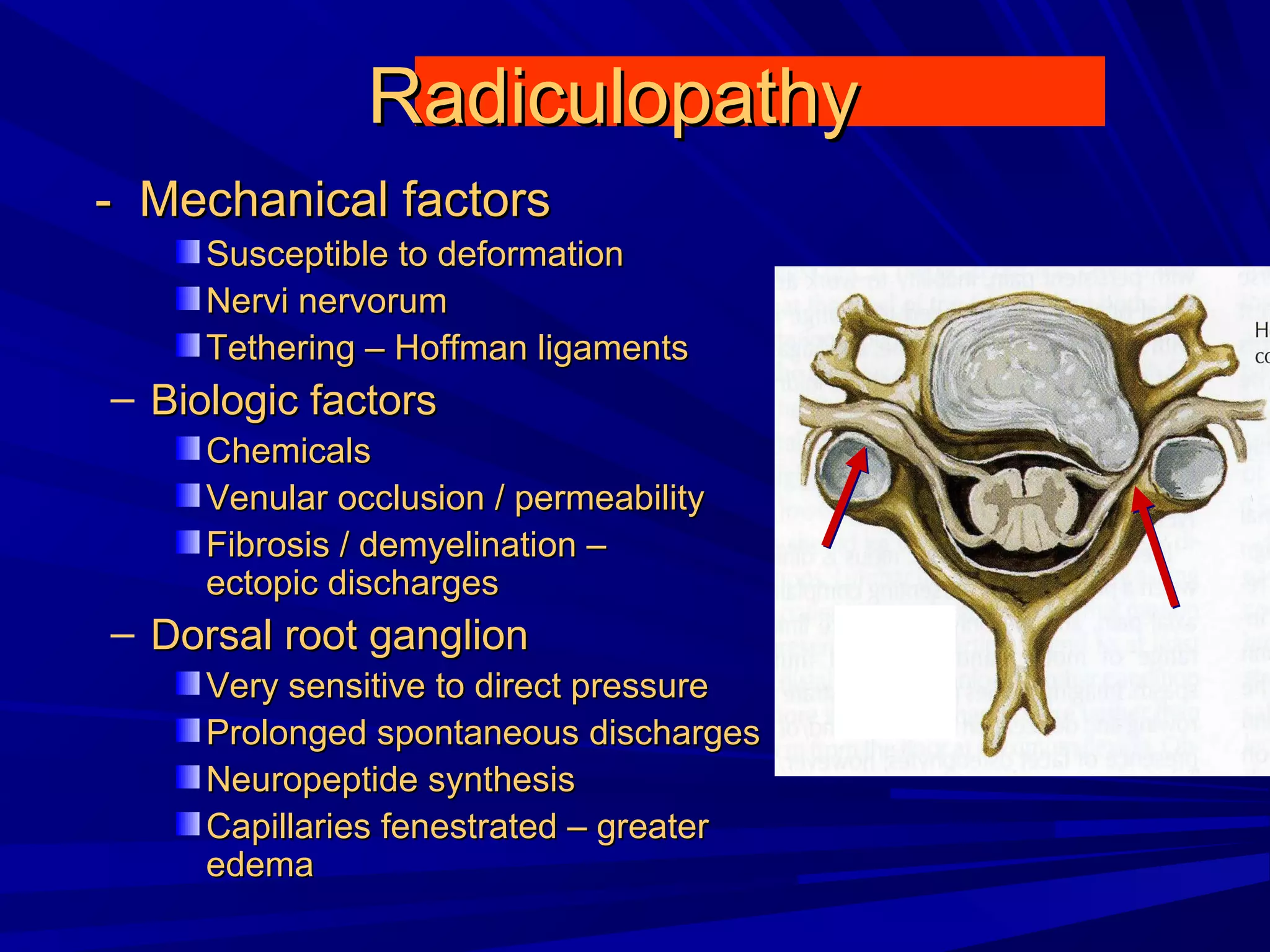 Cervical Radiculopathy 1st Mech Diag 2008 Ppt