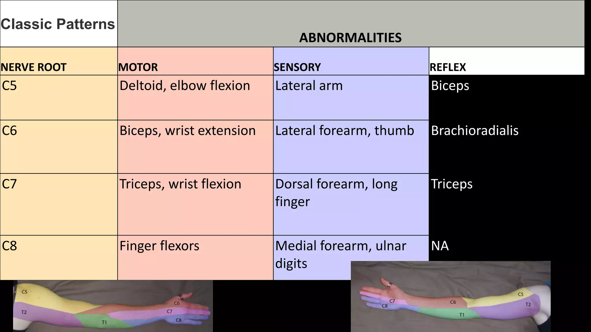 Cervical radiculopathy | PPSX