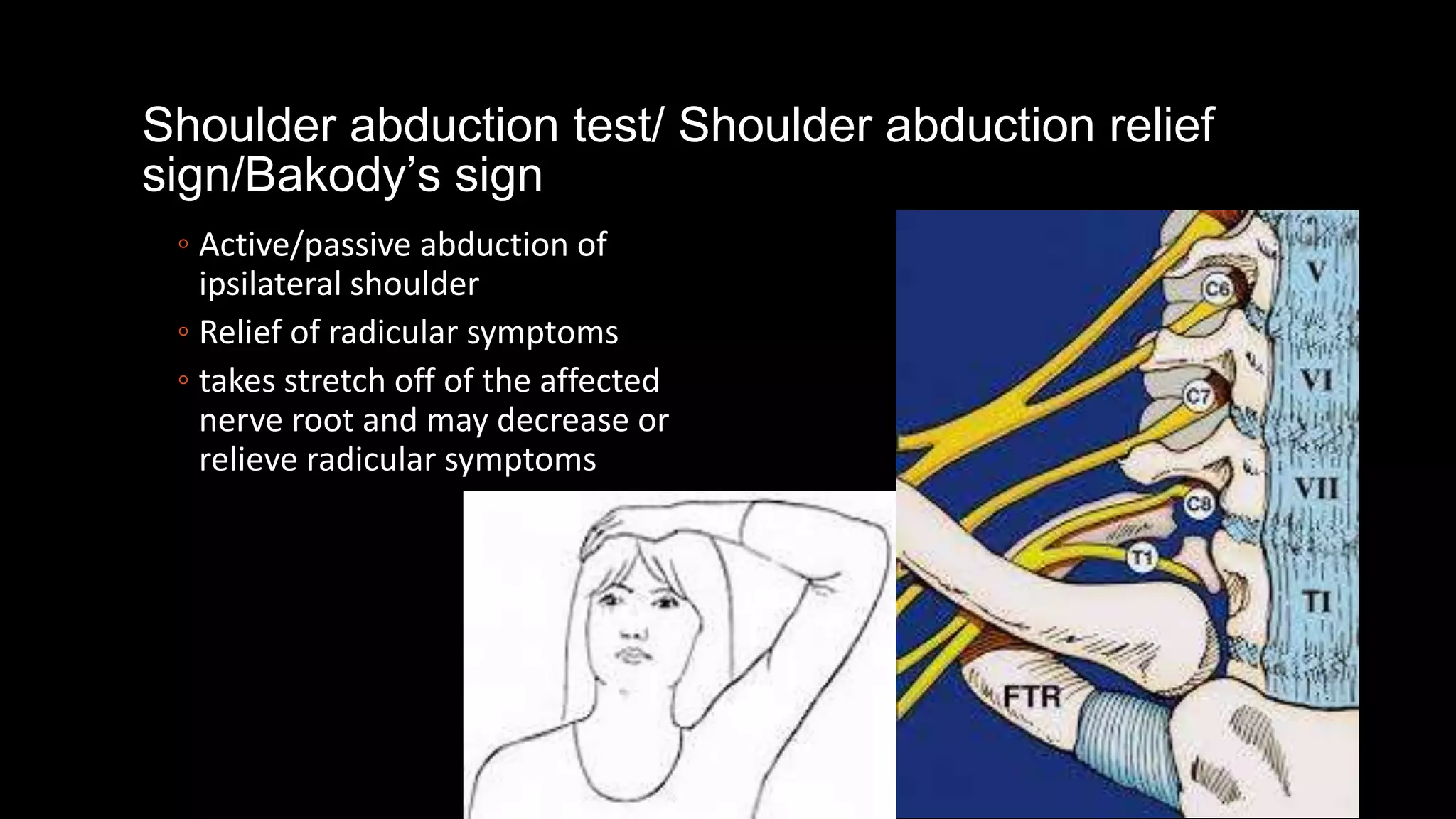 Cervical radiculopathy | PPSX