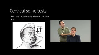 Cervical radiculopathy | PPSX