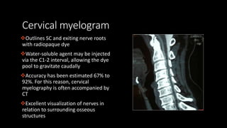 Cervical radiculopathy | PPSX