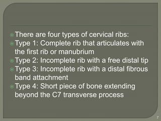 Cervical rib | PPTX | Death, Injury, or Military Conflict | Sensitive ...