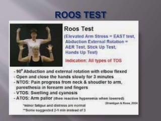 Cervical rib syndrome | PPTX