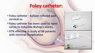 Cervical ripening | PPTX