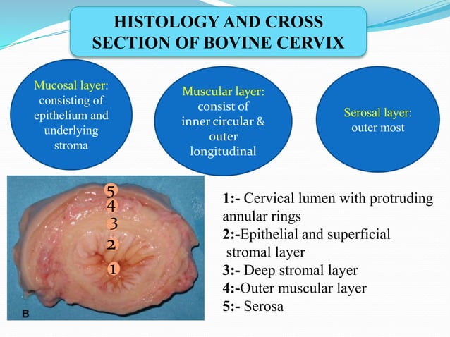 Mechanism of Cervical ripening | PPTX