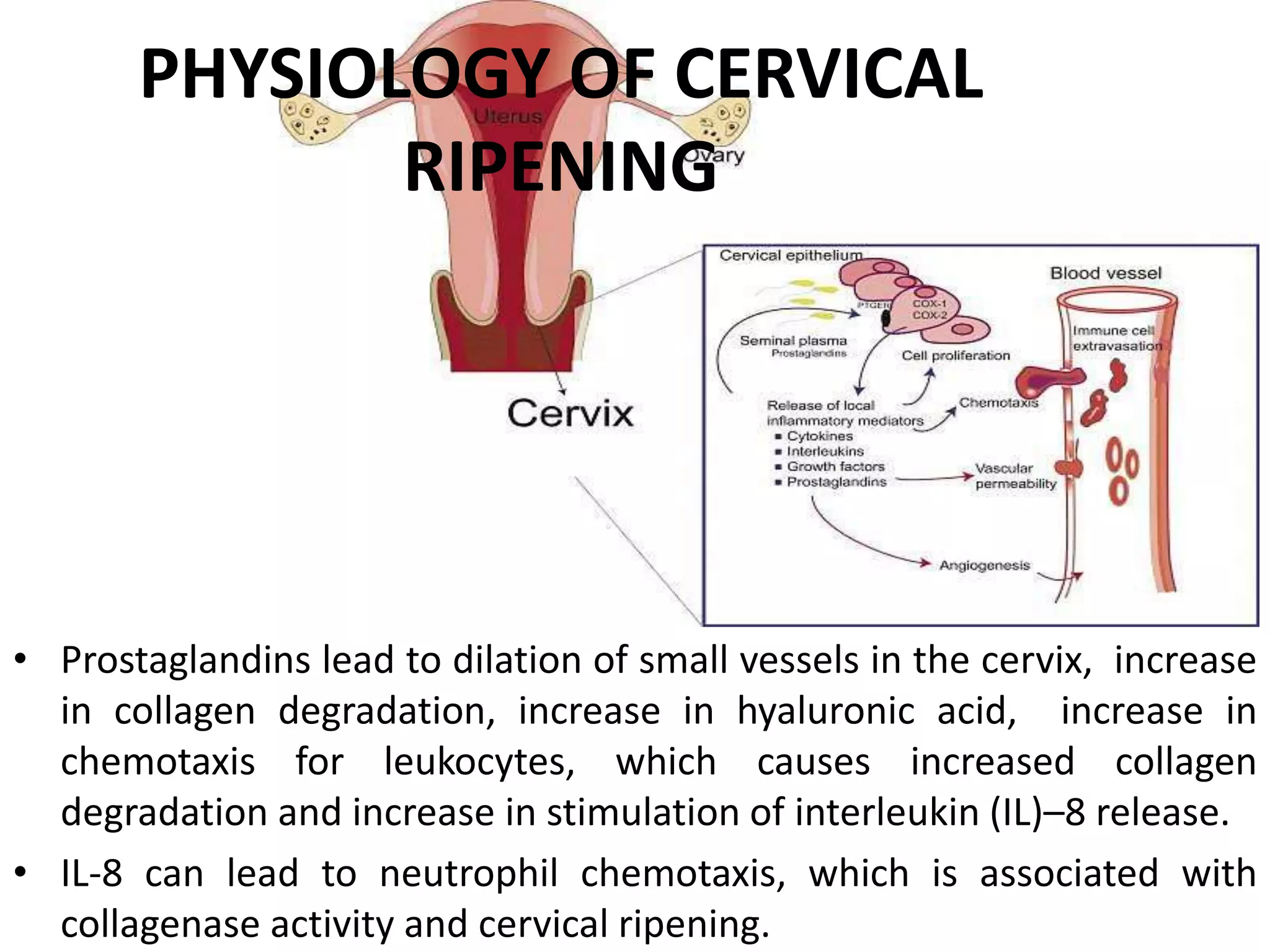 Cervical ripening and the bishop score | PPTX