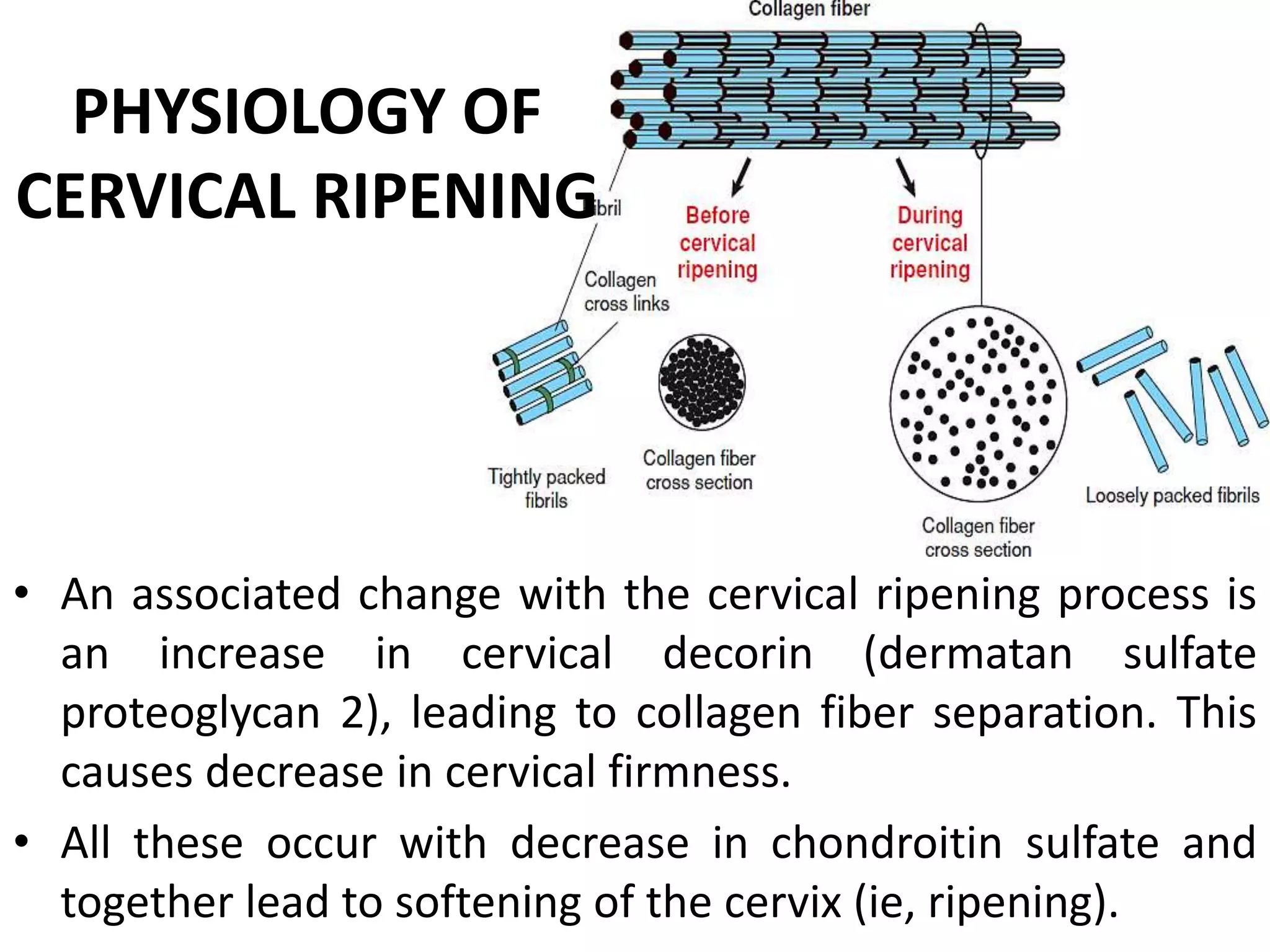 Cervical ripening and the bishop score | PPTX