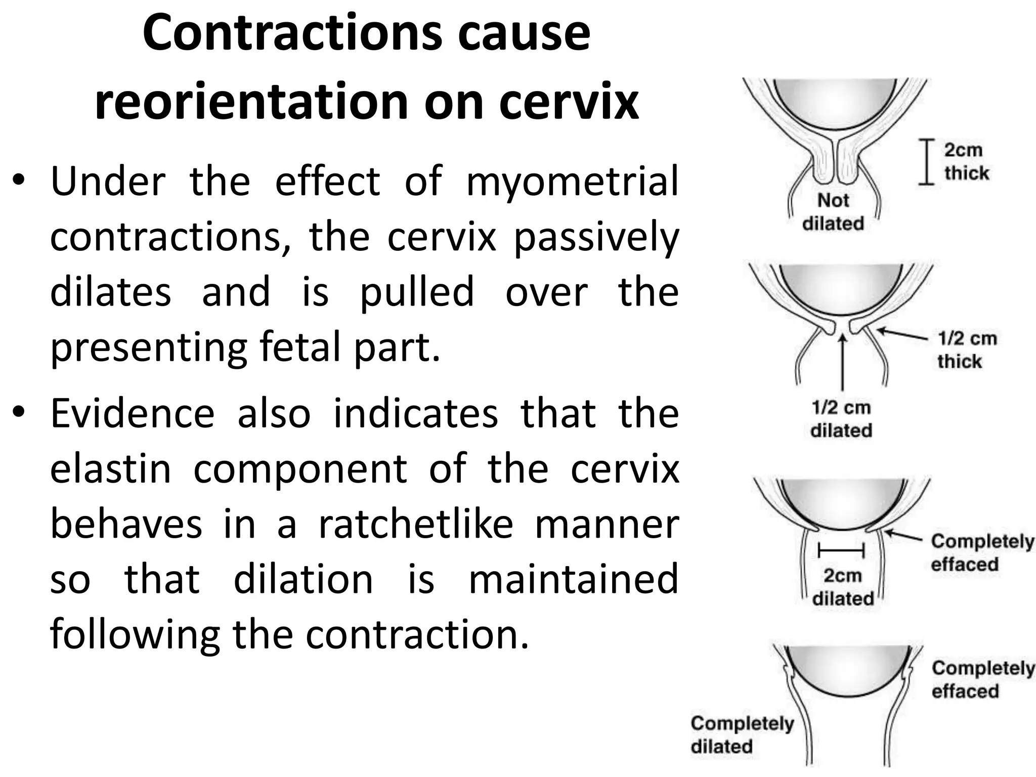 Cervical ripening and the bishop score | PPTX