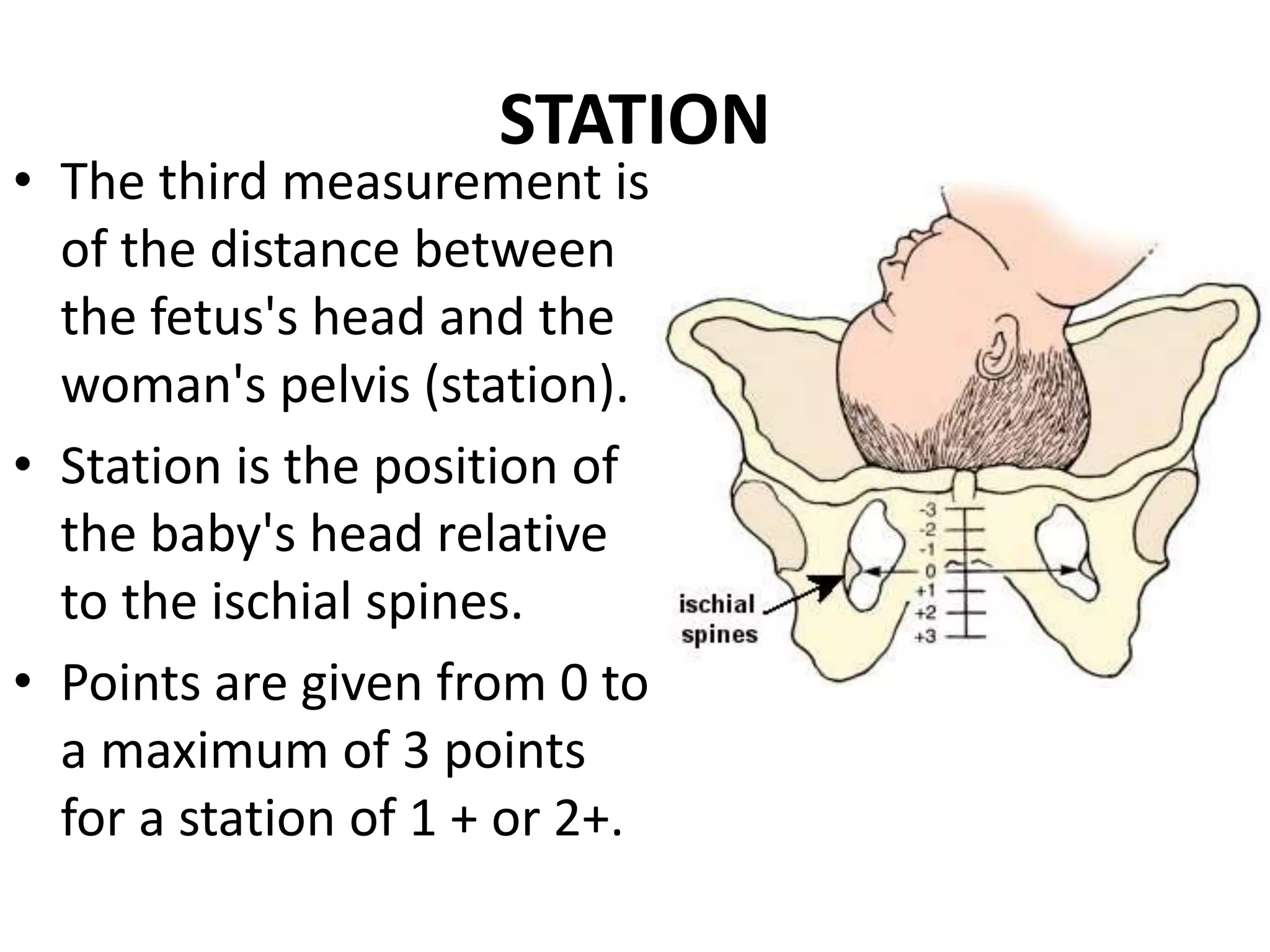 Cervical ripening and the bishop score | PPTX