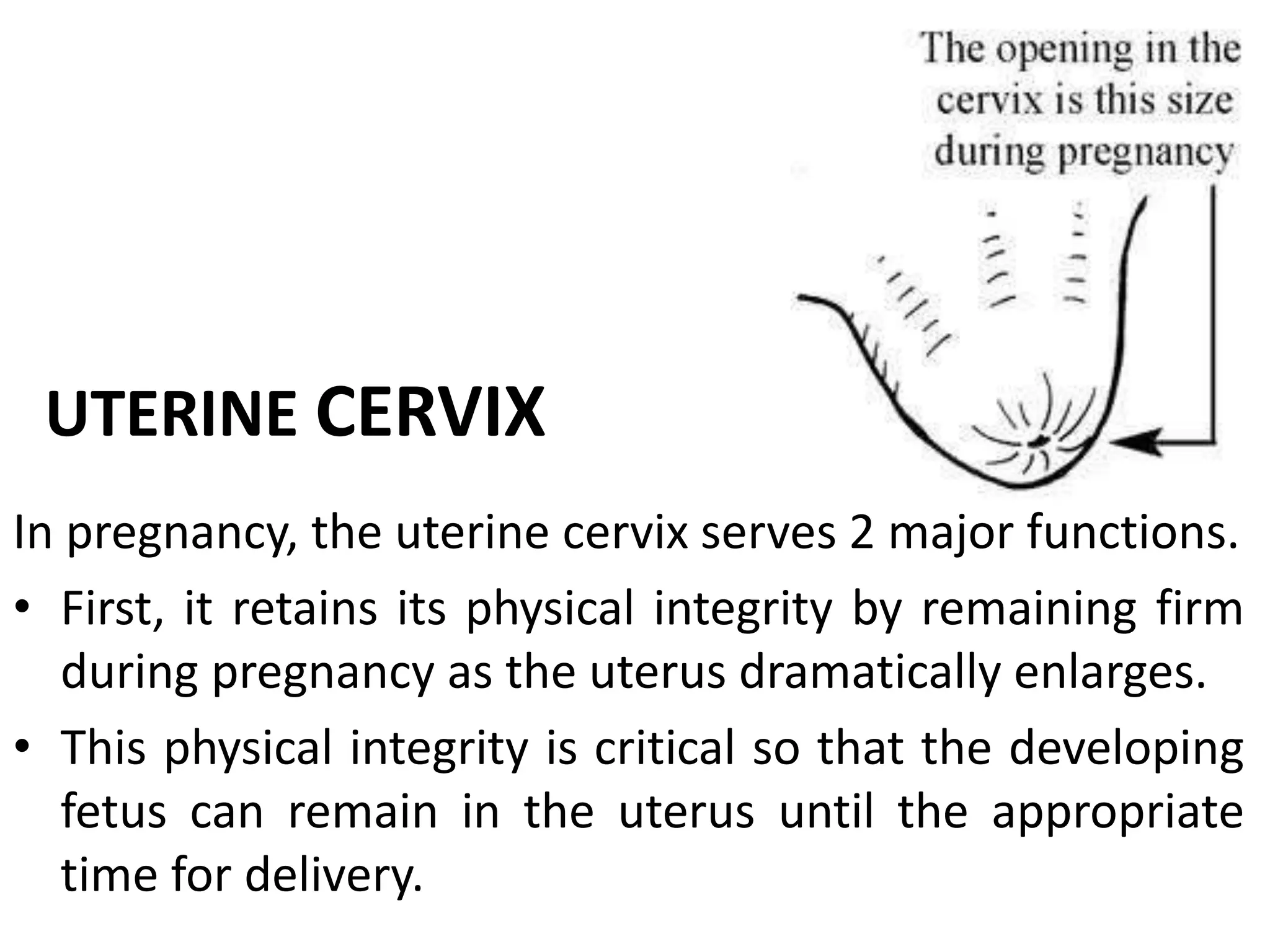 Cervical ripening and the bishop score | PPTX