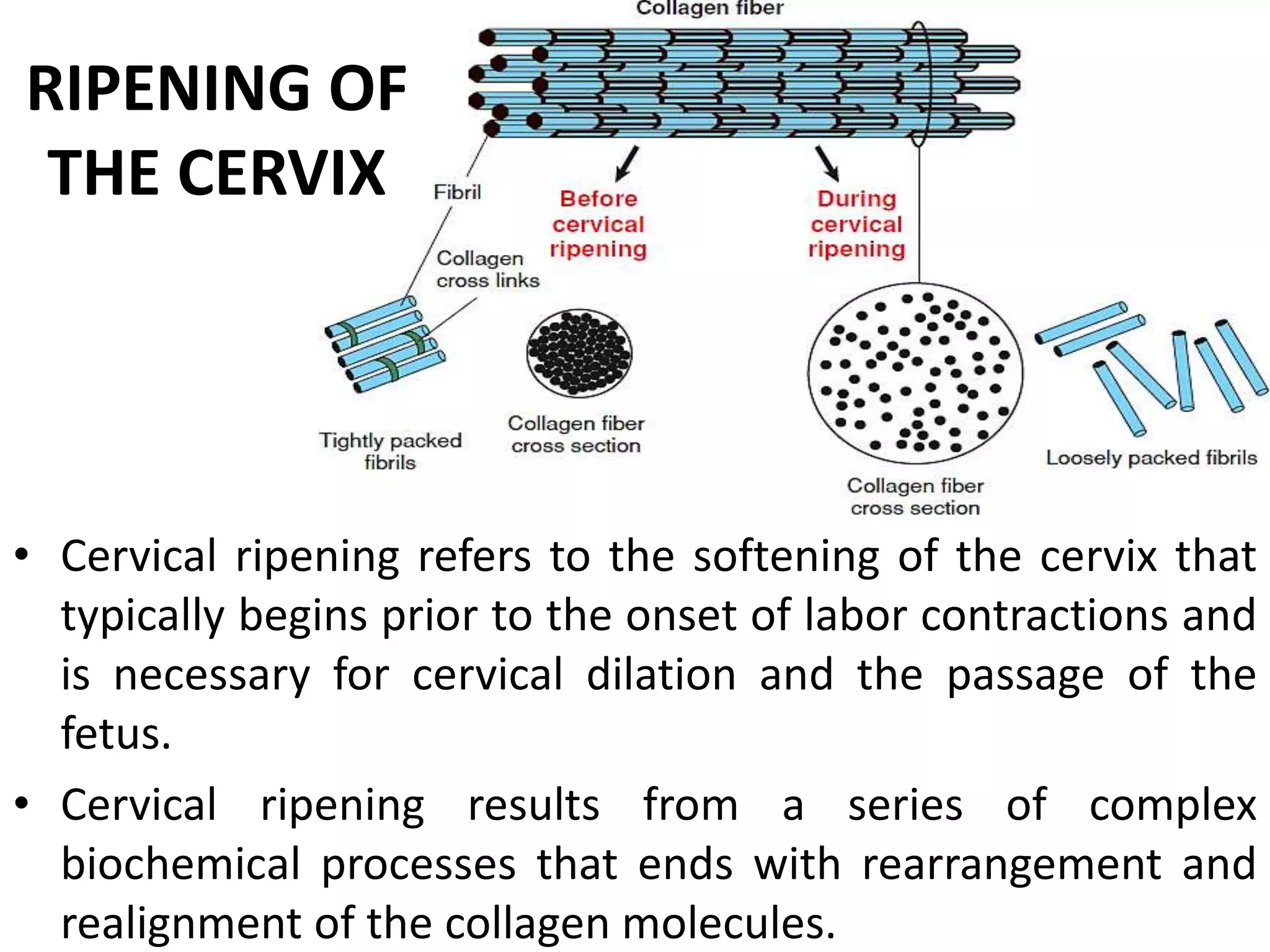 Cervical ripening and the bishop score | PPTX