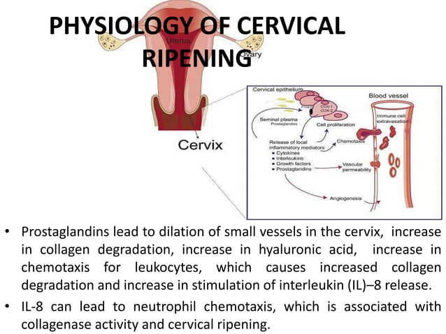 Cervical ripening and the bishop score | PPTX
