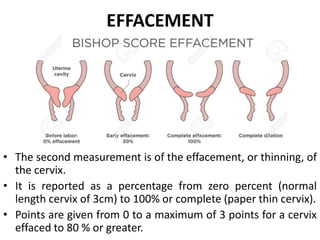 Cervical ripening and the bishop score | PPTX