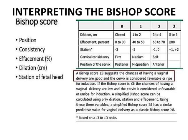 Cervical ripening and the bishop score | PPTX