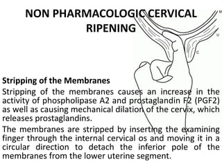 Cervical ripening and the bishop score | PPTX