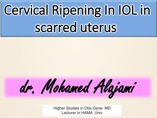 Cervical ripening in iol in scarred uterus | PPT