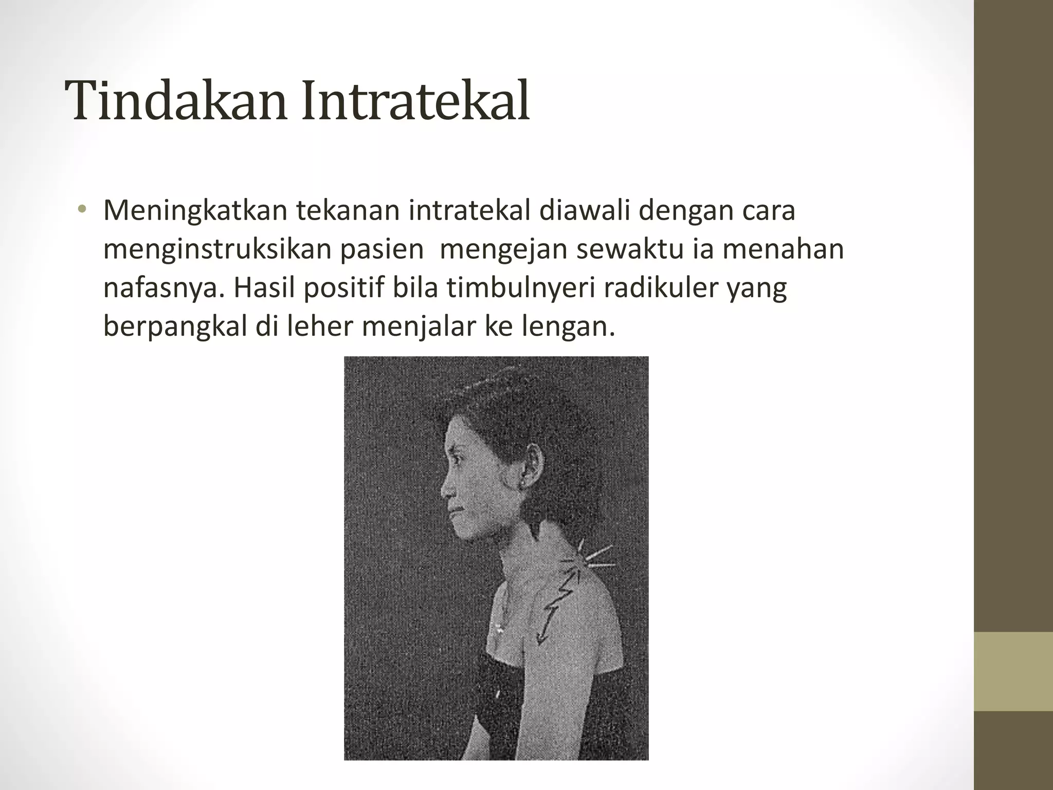 Cervical Root Syndrome.pptx