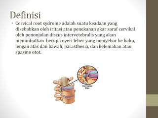 Cervical Root Syndrome.pptx