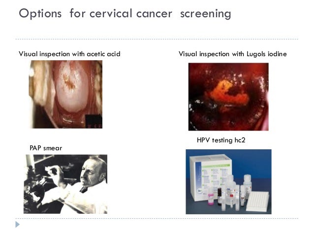 Cervical screening , present past crown plaza final copy
