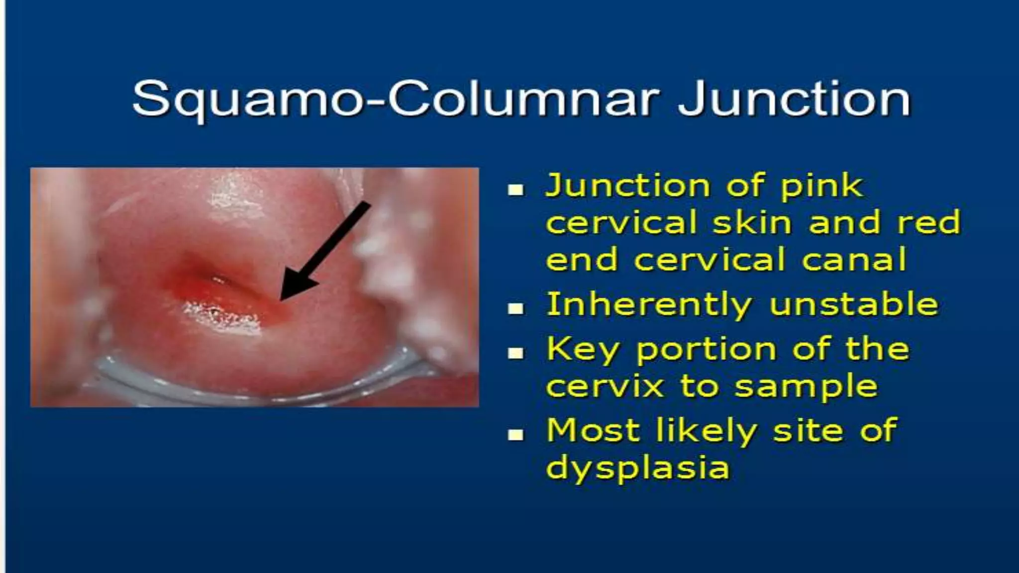 Cervical Screening Program | PPT