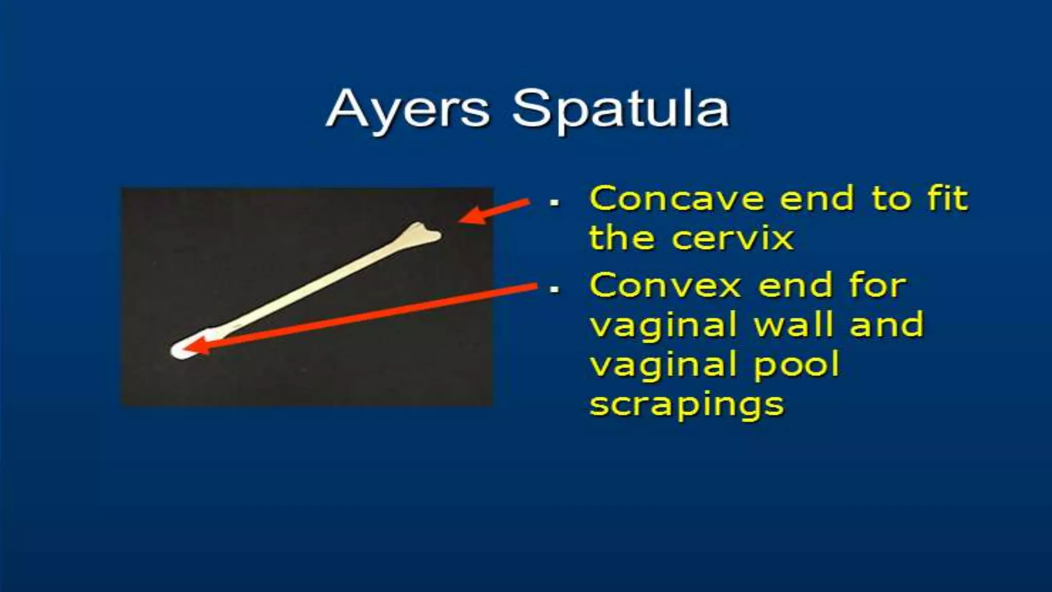 Cervical Screening Program | PPT